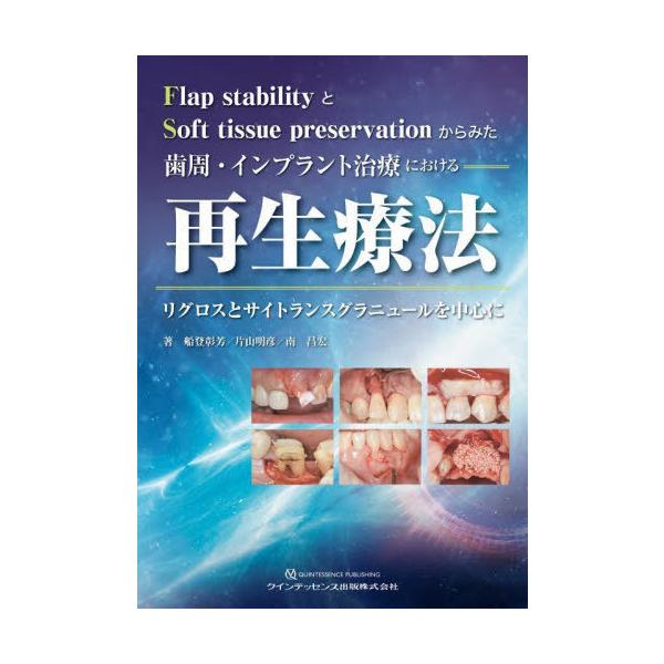 【発売日：2022年05月28日】船登彰芳/著 片山明彦/著 南昌宏/著/歯周・インプラント治療における再生療法 Flap stabilityとSoft tissue preservationからみた リグロスとサイトランスグラニュールを中...