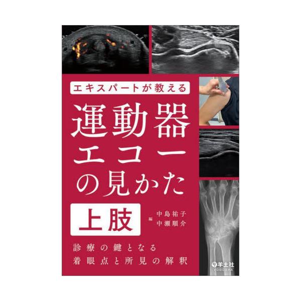 【発売日：2022年07月22日】中島祐子/編 中瀬順介/編/エキスパートが教える運動器エコーの見かた 診療の鍵となる着眼点と所見の解釈 上肢、メディア：BOOK、発売日：2022/07、重量：450g、商品コード：NEOBK-276130...