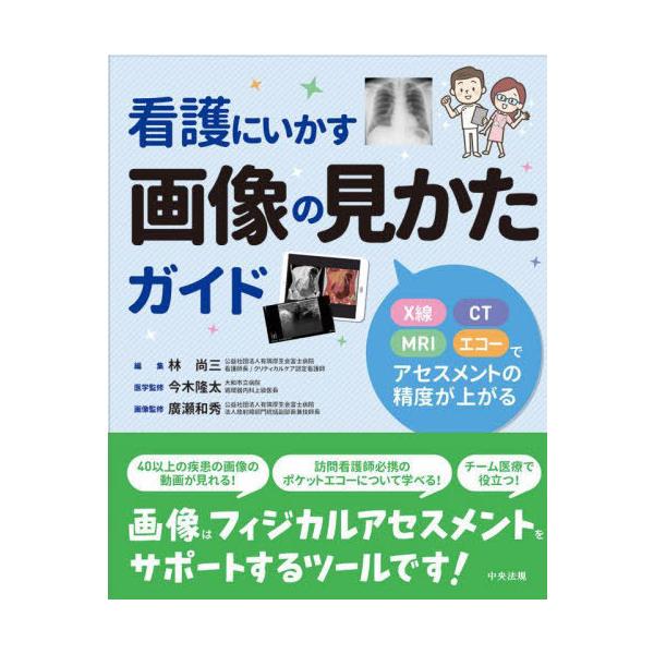 【発売日：2022年07月23日】林尚三/編集 今木隆太/医学監修 廣瀬和秀/画像監修/看護にいかす画像の見かたガイド X線・CT・MRI・エコーでアセスメントの精度が上がる、メディア：BOOK、発売日：2022/07、重量：450g、商品...