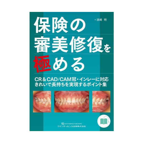 【発売日：2022年11月11日】須崎明/著/保険の審美修復を極める CR&amp;CAD/CAM冠・インレーに対応きれいで長持ちを実現するポイント集 (QUINT KICK-OFF LIBRARY)、メディア：BOOK、発売日：2022/...