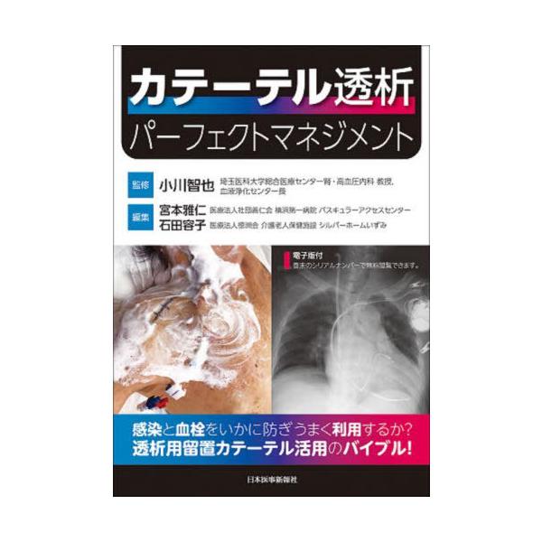 【発売日：2022年11月18日】小川智也/監修 宮本雅仁/編集 石田容子/編集/カテーテル透析パーフェクトマネジメント、メディア：BOOK、発売日：2022/11、重量：343g、商品コード：NEOBK-2801958、JANコード/IS...