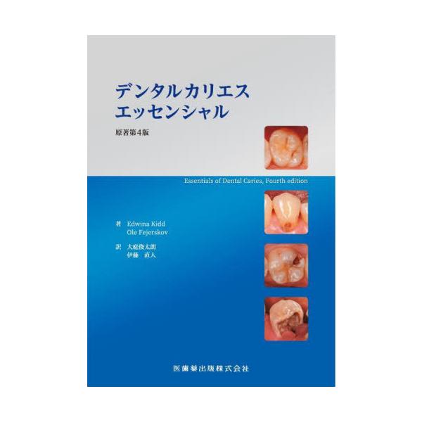 【発売日：2023年02月28日】EdwinaKidd/著 OleFejerskov/著 大庭俊太朗/訳 伊藤直人/訳/デンタルカリエスエッセンシャル 原著4版、メディア：BOOK、発売日：2023/02、重量：500g、商品コード：NEO...