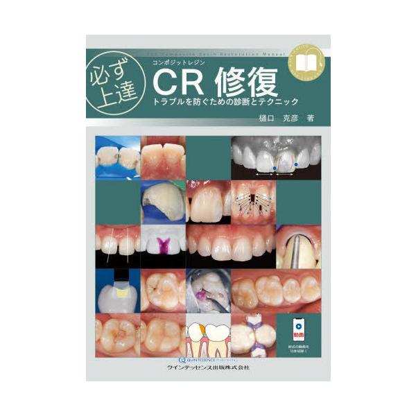 【発売日：2023年03月12日】樋口克彦/著/必ず上達CR(コンポジットレジン)修復 トラブルを防ぐための診断とテクニック (QUINT KICK-OFF LIBRARY)、メディア：BOOK、発売日：2023/03、重量：719g、商品...
