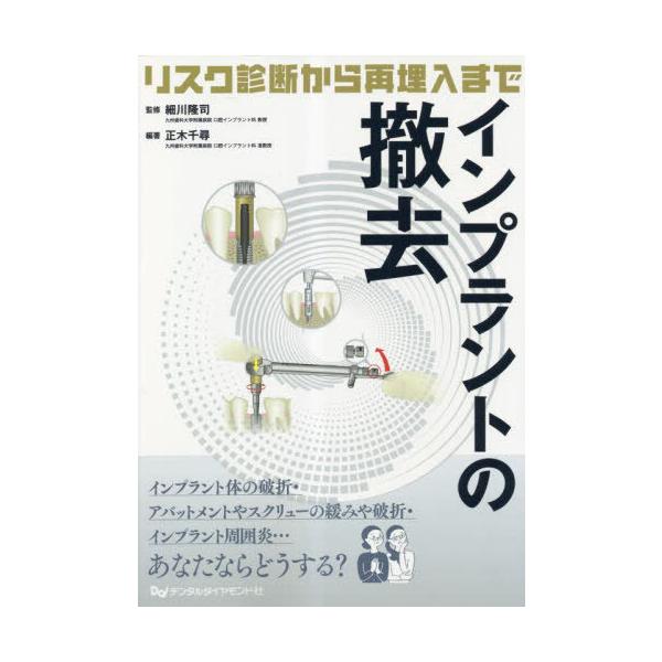 【発売日：2023年04月24日】正木千尋/編著 細川隆司/監修/インプラントの撤去、メディア：BOOK、発売日：2023/04、重量：500g、商品コード：NEOBK-2848976、JANコード/ISBNコード：9784885105586