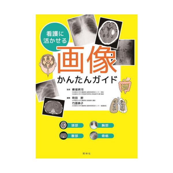 【発売日：2023年08月29日】横堀將司/監修 町田幹/編集 竹原典子/編集/看護に活かせる画像かんたんガイド、メディア：BOOK、発売日：2023/08、重量：500g、商品コード：NEOBK-2894411、JANコード/ISBNコー...