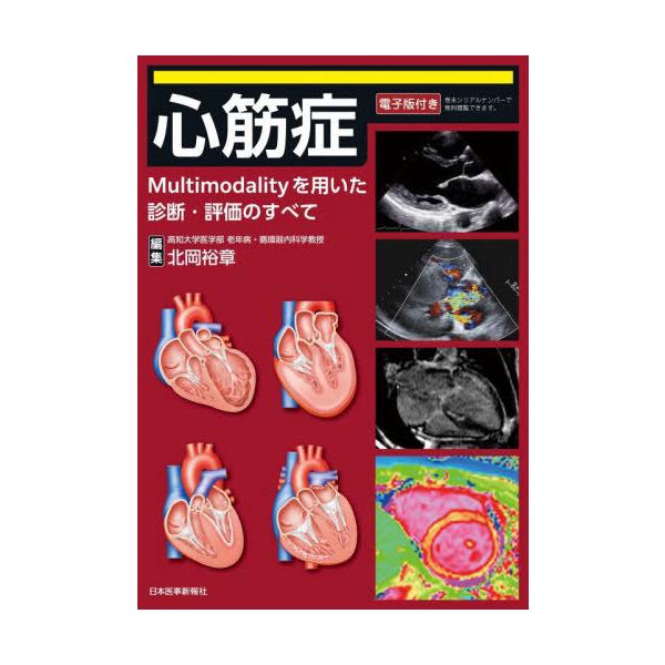 【発売日：2024年01月14日】北岡裕章/編集/心筋症 Multimodalityを用いた診断・評価のすべて、メディア：BOOK、発売日：2024/01、重量：500g、商品コード：NEOBK-2935349、JANコード/ISBNコード...