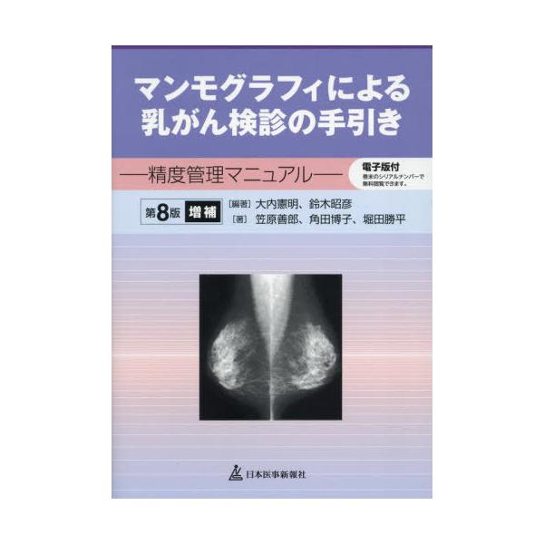 【発売日：2024年02月15日】大内憲明/編著 鈴木昭彦/編著 笠原善郎/〔ほか〕著/マンモグラフィによる乳がん検診の手引き 精度管理マニュアル、メディア：BOOK、発売日：2024/02、重量：500g、商品コード：NEOBK-2947...