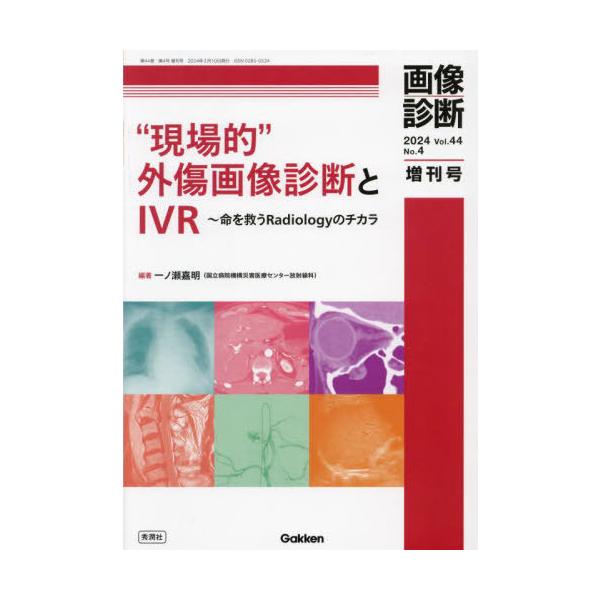 【発売日：2024年03月01日】一ノ瀬嘉明/編著/“現場的”外傷画像診断とIVR 命を救うRadiologyのチカラ、メディア：BOOK、発売日：2024/03、重量：500g、商品コード：NEOBK-2953217、JANコード/ISB...