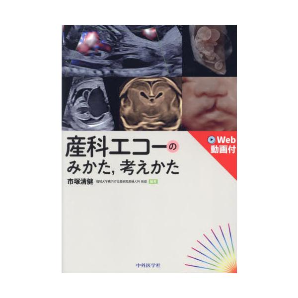 【発売日：2024年04月04日】市塚清健/編著/産科エコーのみかた 考えかた、メディア：BOOK、発売日：2024/04、重量：500g、商品コード：NEOBK-2968360、JANコード/ISBNコード：9784498160545