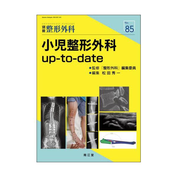 【発売日：2024年04月28日】松田秀一/編集/小児整形外科up‐to‐date (別冊整形外科)、メディア：BOOK、発売日：2024/04、重量：500g、商品コード：NEOBK-2972428、JANコード/ISBNコード：9784...