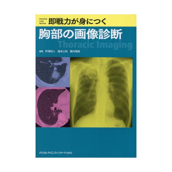 【発売日：2024年04月15日】芦澤和人/編集 藤本公則/編集 藪内英剛/編集/即戦力が身につく胸部の画像診断、メディア：BOOK、発売日：2024/04、重量：500g、商品コード：NEOBK-2972834、JANコード/ISBNコー...