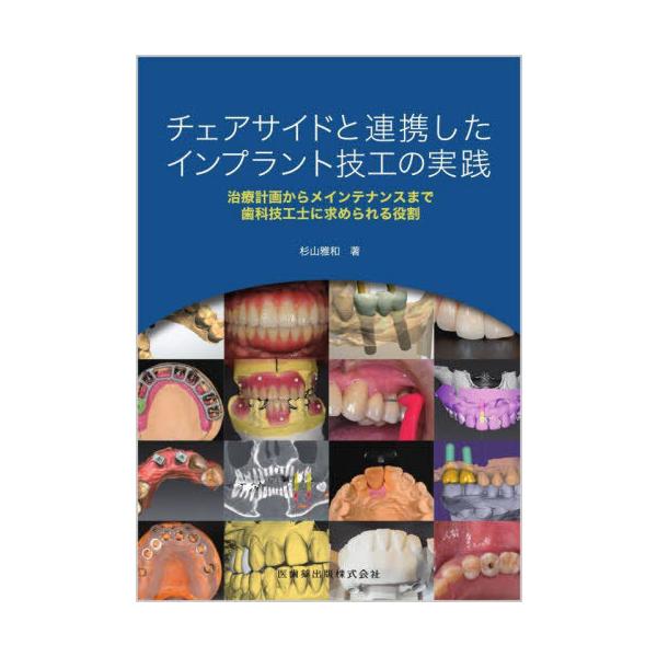 【発売日：2024年09月20日】杉山雅和/著/チェアサイドと連携したインプラント技工の、メディア：BOOK、発売日：2024/09、重量：500g、商品コード：NEOBK-3020229、JANコード/ISBNコード：9784263462256