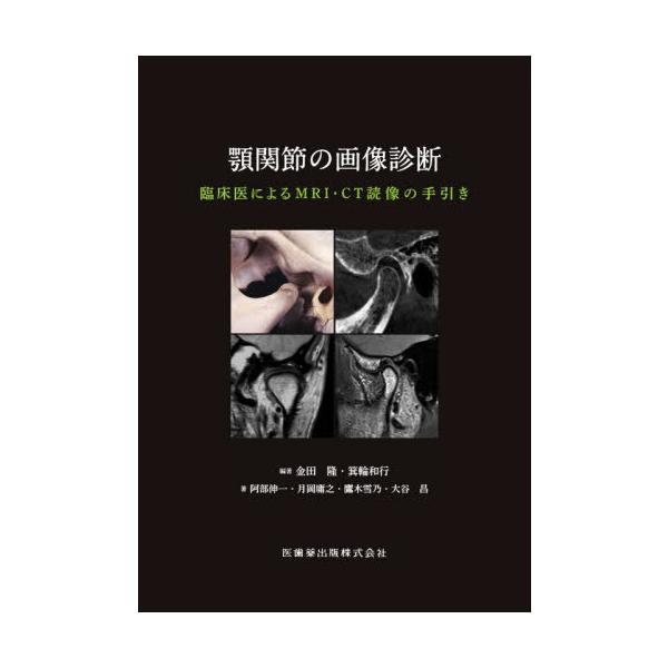【発売日：2024年09月28日】金田隆/編著 箕輪和行/編著 阿部伸一/〔ほか〕著/顎関節の画像診断、メディア：BOOK、発売日：2024/09、重量：759g、商品コード：NEOBK-3022371、JANコード/ISBNコード：978...