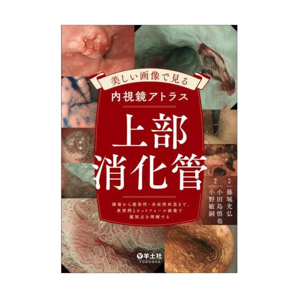 【発売日：2024年10月17日】藤城光弘/監修 小田島慎也/編集 小野敏嗣/編集/美しい画像で見る内視鏡アトラス上部消化管 腫瘍から感染性・炎症性疾患まで、典型例とピットフォール画像で鑑別点を理解する、メディア：BOOK、発売日：2024...