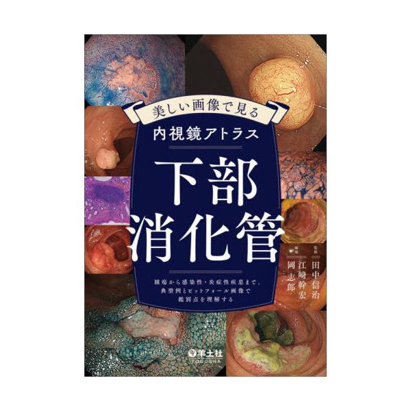 【発売日：2024年10月17日】田中信治/監修 江崎幹宏/編集 岡志郎/編集/美しい画像で見る内視鏡アトラス下部消化管 腫瘍から感染性・炎症性疾患まで、典型例とピットフォール画像で鑑別点を理解する、メディア：BOOK、発売日：2024/1...