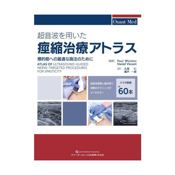 【発売日：2024年11月10日】PaulWinston/編著 DanielVincent/編著 久保仁/訳 瀬戸一郎/訳/超音波を用いた痙縮治療アトラス 標的筋への最適な施注のために / 原タイトル:Atlas of Ultasound‐...