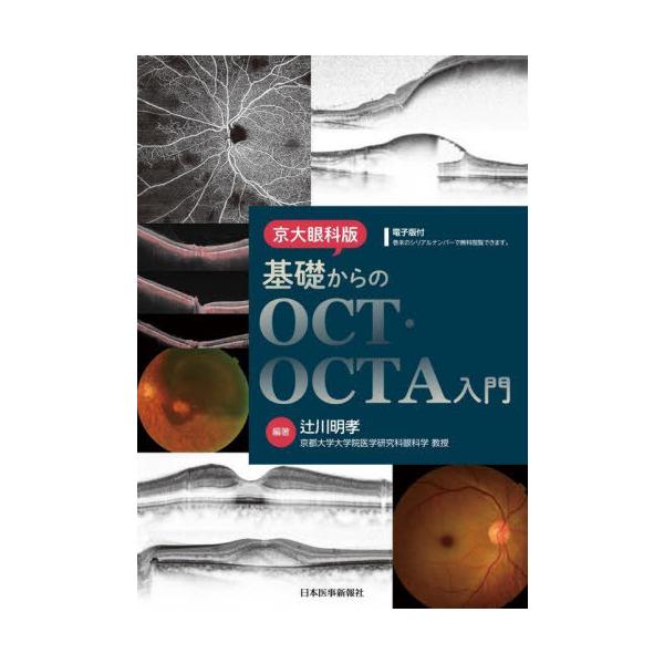 【発売日：2024年11月27日】辻川明孝/編著/京大眼科版基礎からのOCT・OCTA入門、メディア：BOOK、発売日：2024/11、重量：500g、商品コード：NEOBK-3036172、JANコード/ISBNコード：978478491...