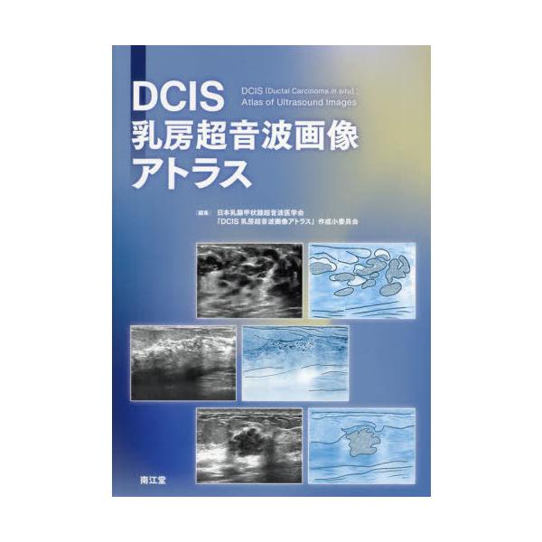 【発売日：2024年11月13日】日本乳腺甲状腺超音波医学会「DCIS乳房超音波画像アトラス」作成小委員会/編集/DCIS乳房超音波画像アトラス、メディア：BOOK、発売日：2024/11、重量：500g、商品コード：NEOBK-30362...