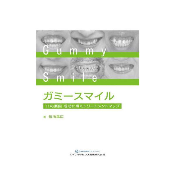 【発売日：2024年12月08日】伝法昌広/著/ガミースマイル 11の要因成功に導くトリートメントマップ、メディア：BOOK、発売日：2024/12、重量：851g、商品コード：NEOBK-3045920、JANコード/ISBNコード：97...
