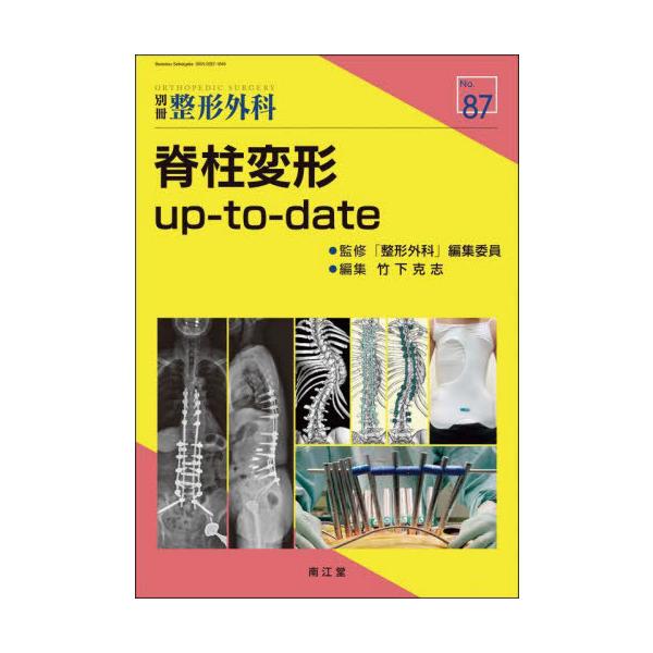 【発売日：2025年04月28日】竹下克志/編集/脊柱変形up‐to‐date (別冊整形外科)、メディア：BOOK、発売日：2025/04、重量：500g、商品コード：NEOBK-3088378、JANコード/ISBNコード：978452...