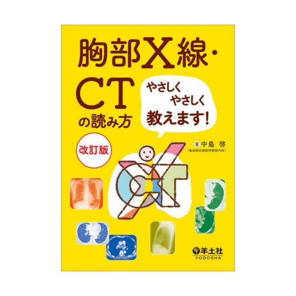 【発売日：2025年04月20日】中島啓/著/胸部X線・CTの読み方やさしくやさしく教えます!、メディア：BOOK、発売日：2025/04、重量：500g、商品コード：NEOBK-3089644、JANコード/ISBNコード：9784758...