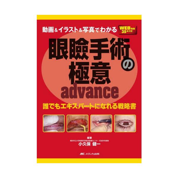 【発売日：2025年04月30日】小久保健一/編著/動画&amp;イラスト&amp;写真でわかる眼瞼手術の極意advance 誰でもエキスパートになれる戦略書、メディア：BOOK、発売日：2025/04、重量：500g、商品コード：NEOB...