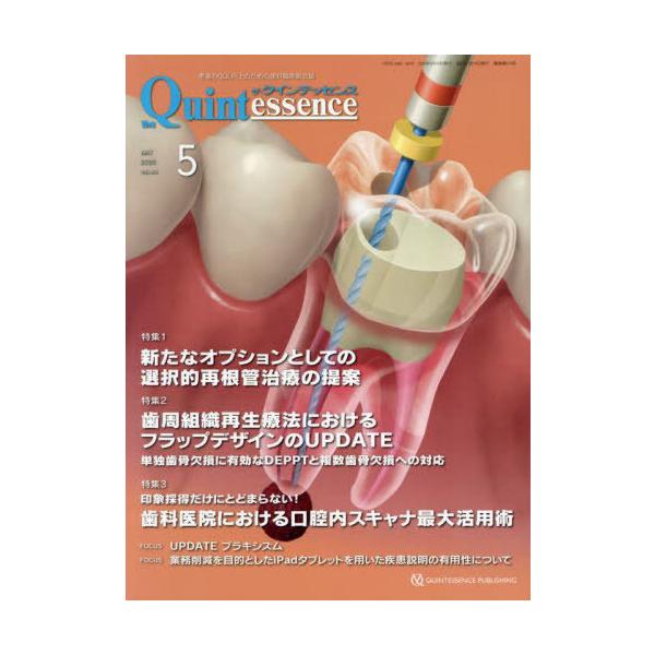 【発売日：2025年05月28日】クインテッセンス出版/ザ・クインテッセンス vol.44/no.5(2025MAY)、メディア：BOOK、発売日：2025/05、重量：500g、商品コード：NEOBK-3094805、JANコード/ISB...