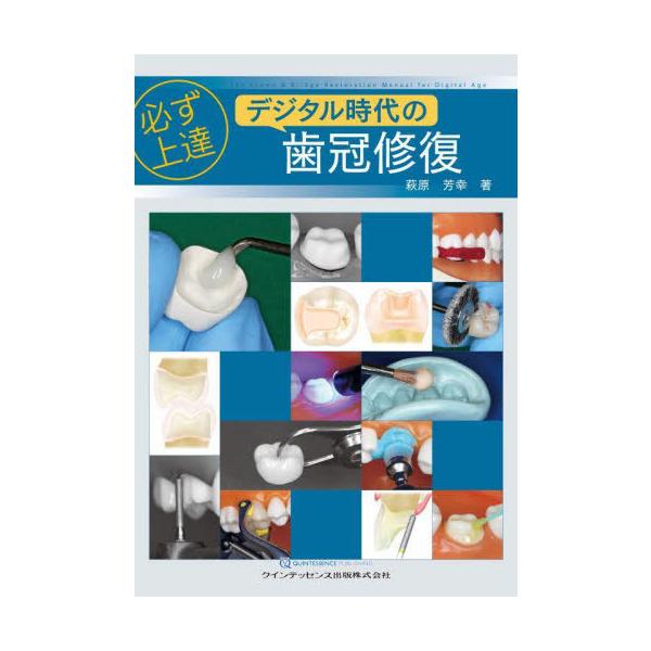 【発売日：2025年06月08日】萩原芳幸/著/必ず上達デジタル時代の歯冠修復、メディア：BOOK、発売日：2025/06、重量：500g、商品コード：NEOBK-3102976、JANコード/ISBNコード：9784781211329