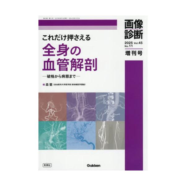 【発売日：2025年08月31日】森墾/編/これだけ押さえる全身の血管解剖 破格から病態まで、メディア：BOOK、発売日：2025/08、重量：587g、商品コード：NEOBK-3129606、JANコード/ISBNコード：97840552...