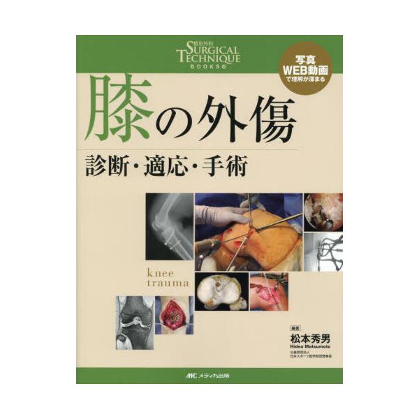 【発売日：2025年09月26日】松本秀男/編著/膝の外傷 診断・適応・手術 写真・WEB動画で理解が深まる (整形外科SURGICAL TECHNIQUE BOOKS 14)、メディア：BOOK、発売日：2025/09、重量：500g、商...