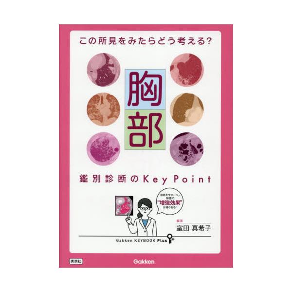 【発売日：2025年09月26日】室田真希子/編著/胸部鑑別診断のKey Point この所見をみたらどう考える? (Gakken KEYBOOK Plus)、メディア：BOOK、発売日：2025/09、重量：500g、商品コード：NEOB...