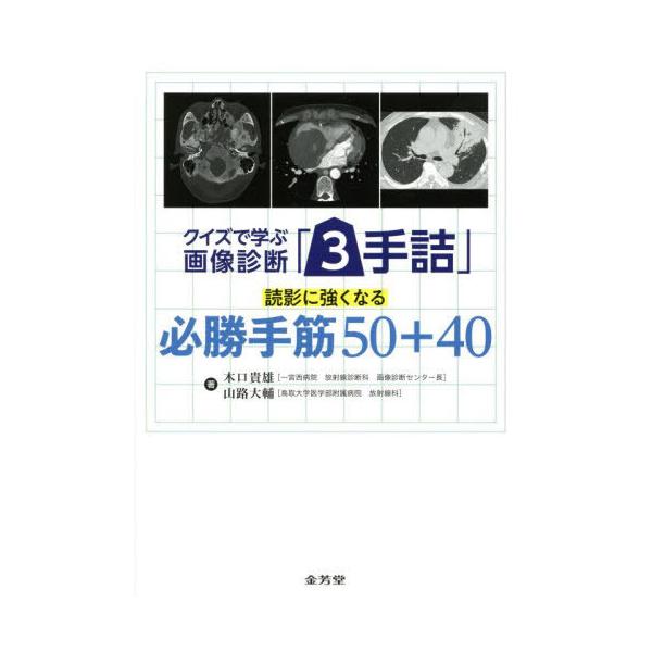 【発売日：2025年09月20日】木口貴雄/著 山路大輔/著/クイズで学ぶ画像診断「3手詰」読影に強くなる必勝手筋50+40、メディア：BOOK、発売日：2025/09、重量：705g、商品コード：NEOBK-3139484、JANコード/...