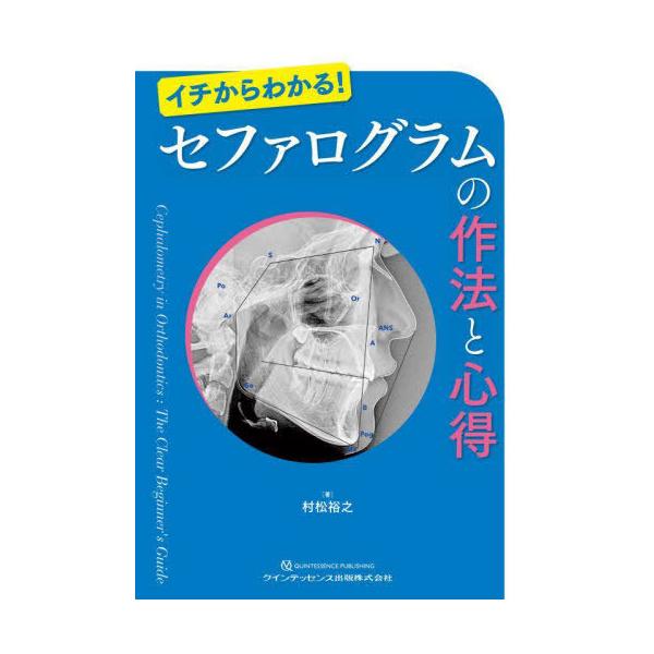 【発売日：2025年10月10日】村松裕之/著/イチからわかる!セファログラムの作法と心得、メディア：BOOK、発売日：2025/10、重量：500g、商品コード：NEOBK-3142083、JANコード/ISBNコード：978478121...