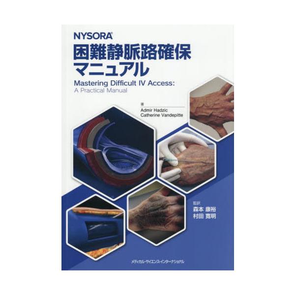 【発売日：2025年09月28日】AdmirHadzic/著 CatherineVandepitte/著 森本康裕/監訳 村田寛明/監訳/NYSORA 困難静脈路確保マニュアル、メディア：BOOK、発売日：2025/09、重量：433g、商...