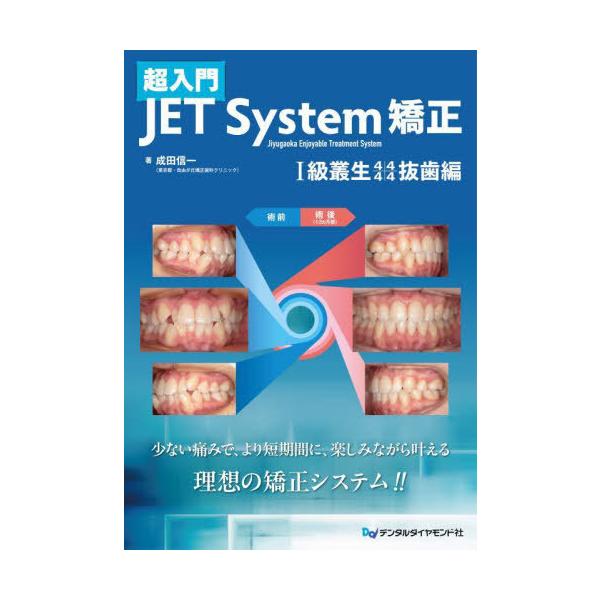 【発売日：2025年10月05日】成田信一/著/超入門JET Syste 4444抜歯編、メディア：BOOK、発売日：2025/10、重量：500g、商品コード：NEOBK-3142631、JANコード/ISBNコード：9784885106361