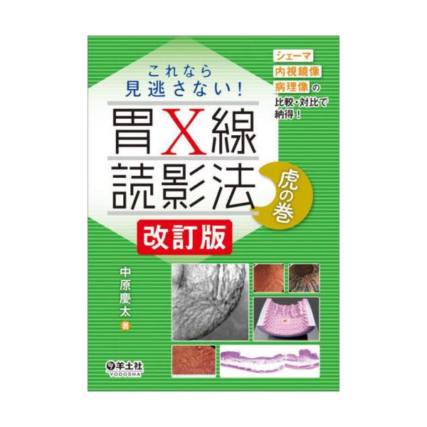 【発売日：2025年10月22日】中原慶太/著/これなら見逃さない!胃X線読影法虎の巻 シェーマ内視鏡像病理像の比較・対比で納得!、メディア：BOOK、発売日：2025/10、重量：500g、商品コード：NEOBK-3147536、JANコ...