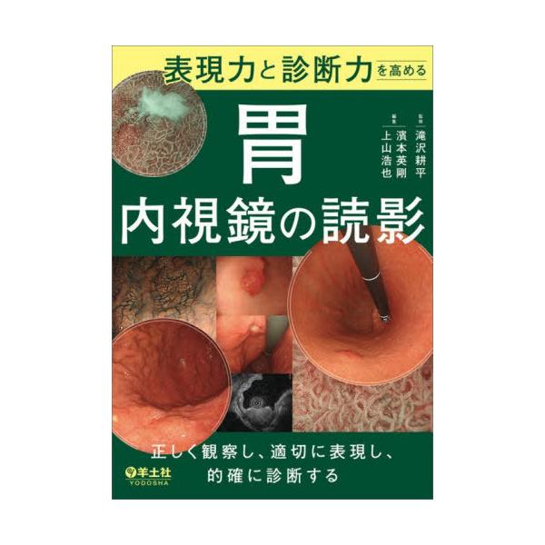 【発売日：2025年11月06日】滝沢耕平/監修 濱本英剛/編集 上山浩也/編集/表現力と診断力を高める胃内視鏡の読影 正しく観察し、適切に表現し、的確に診断する、メディア：BOOK、発売日：2025/11、重量：500g、商品コード：NE...
