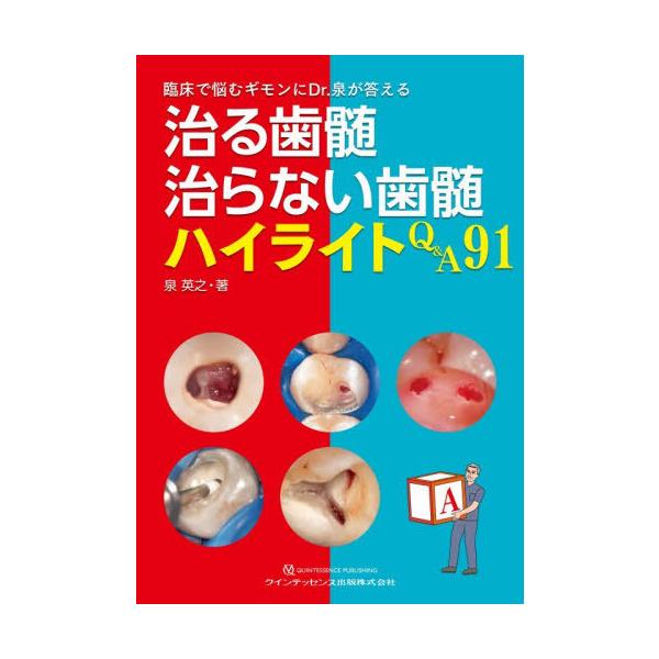 【発売日：2025年11月07日】泉英之/著/治る歯髄治らない歯髄ハイライトQ&amp;A91 臨床で悩むギモンにDr.泉が答える、メディア：BOOK、発売日：2025/11、重量：500g、商品コード：NEOBK-3153471、JANコ...
