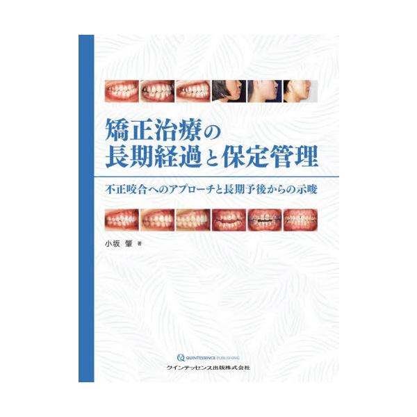 【発売日：2025年11月07日】小坂肇/著/矯正治療の長期経過と保定管理 不正咬合へのアプローチと長期予後からの示唆、メディア：BOOK、発売日：2025/11、重量：500g、商品コード：NEOBK-3153473、JANコード/ISB...