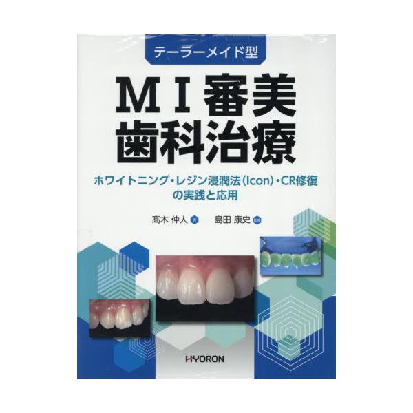 【発売日：2025年08月28日】高木仲人島田康史/テーラーメイド型 MI審美歯科治療、メディア：BOOK、発売日：2025/08、重量：500g、商品コード：NEOBK-3155279、JANコード/ISBNコード：9784864320900