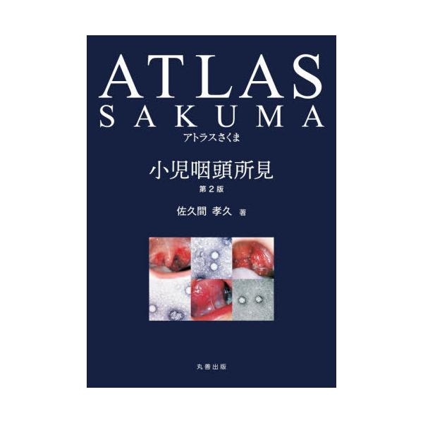 【発売日：2025年11月28日】佐久間孝久/著/アトラスさくま 小児咽頭所見、メディア：BOOK、発売日：2025/11、重量：500g、商品コード：NEOBK-3162295、JANコード/ISBNコード：9784621311943