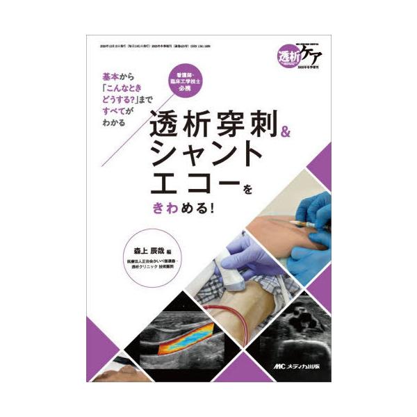 【発売日：2025年12月28日】森上辰哉/編/透析穿刺&amp;シャントエコーをきわめる! 基本から「こんなときどうする?」まですべてがわかる 看護師・臨床工学技士必携、メディア：BOOK、発売日：2025/12、重量：500g、商品コー...