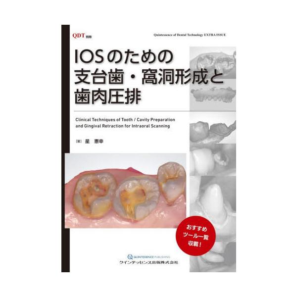 【発売日：2025年12月28日】星憲幸/著/IOSのための支台歯・窩洞形成と歯肉圧排、メディア：BOOK、発売日：2025/12、重量：500g、商品コード：NEOBK-3164842、JANコード/ISBNコード：9784781211664