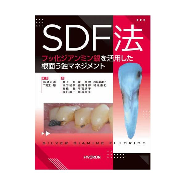 【発売日：2025年10月28日】福島正義二階堂徹/SDF法-フッ化ジアンミン銀を活用した根、メディア：BOOK、発売日：2025/10、重量：500g、商品コード：NEOBK-3168968、JANコード/ISBNコード：97848643...
