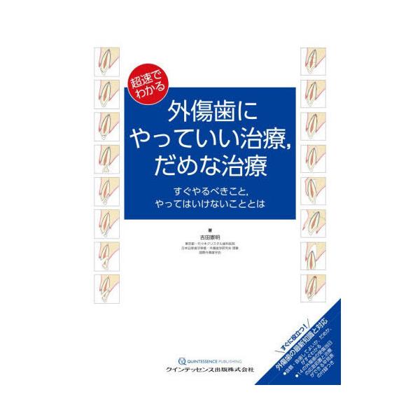 【発売日：2026年02月28日】吉田憲明/著/超速でわかる外傷歯にやっていい治療 だめな治療 すぐやるべきこと やってはいけないこととは、メディア：BOOK、発売日：2026/02、重量：500g、商品コード：NEOBK-3181611、...