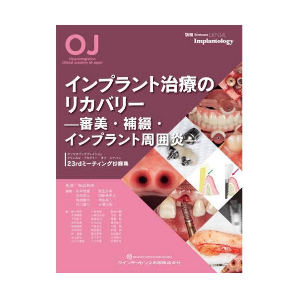 【発売日：2026年02月28日】金成雅彦/監修 松井徳雄/〔ほか〕編集 鮎川保則/〔ほか〕著/インプラント治療のリカバリー (別冊QuintessenceDENTAL)、メディア：BOOK、発売日：2026/02、重量：500g、商品コー...