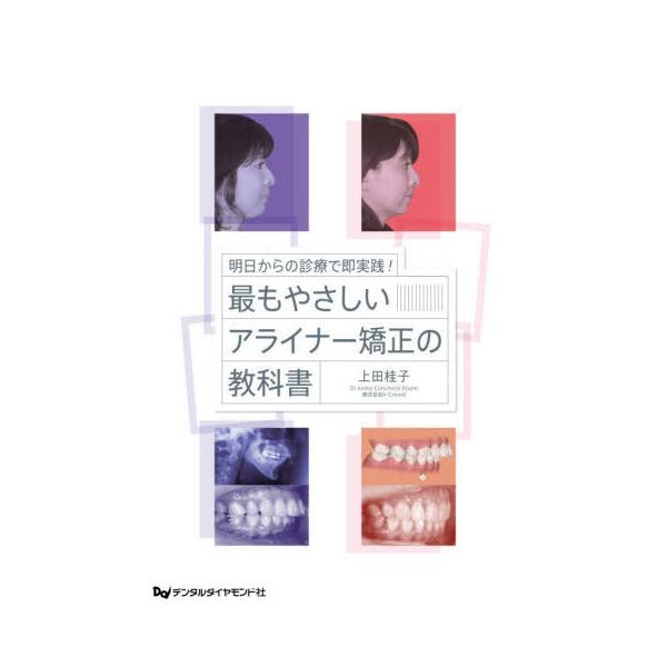 【発売日：2026年03月14日】上田桂子/最もやさしいアライナー矯正の教科書、メディア：BOOK、発売日：2026/03、重量：500g、商品コード：NEOBK-3191169、JANコード/ISBNコード：9784885106514
