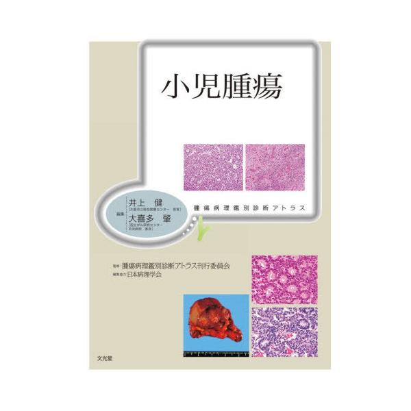 【発売日：2026年03月10日】井上健大喜多肇/小児腫瘍 (腫瘍病理鑑別診断アトラス)、メディア：BOOK、発売日：2026/03、重量：500g、商品コード：NEOBK-3193653、JANコード/ISBNコード：9784830622724