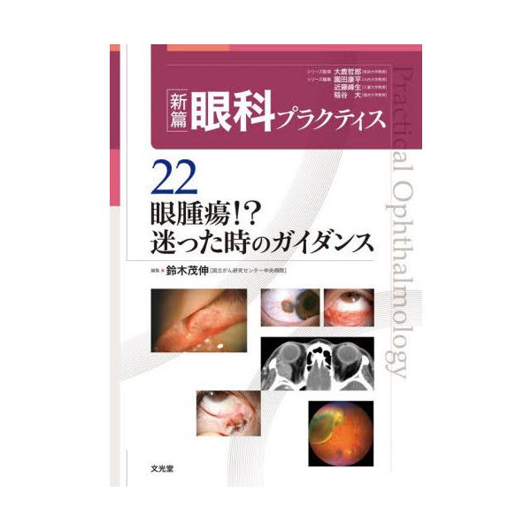 【発売日：2026年04月08日】大鹿哲郎/シリーズ監修 園田康平/シリーズ編集 近藤峰生/シリーズ編集 稲谷大/シリーズ編集/眼腫瘍!?迷った時のガイダンス (新篇眼科プラクティス)、メディア：BOOK、発売日：2026/04、重量：50...