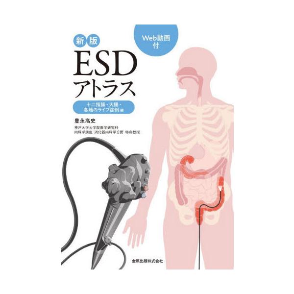 【発売日：2026年04月28日】豊永高史/著/ESDアトラス 十二指腸・大腸・各地のライブ症例編、メディア：BOOK、発売日：2026/04、重量：500g、商品コード：NEOBK-3208778、JANコード/ISBNコード：97843...